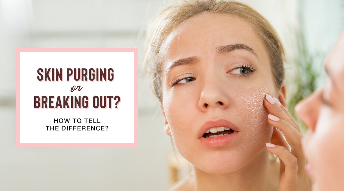 New skincare causing breakouts? Or is my skin just purging? – VIIMART